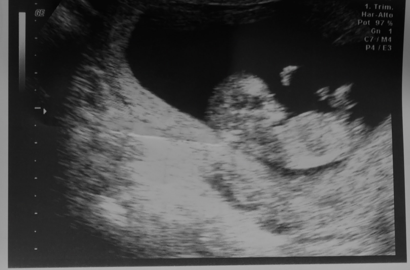 EL SOL SALIENDO Y LA BARRIGA CRECIENDO