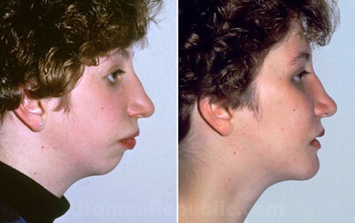 A poorly written collection of musings generated by a serial underdog ...