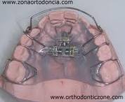 ORTODONCIA: PLACA PROGENIE