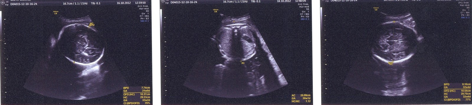 Taj Ma Baby: 32 Week Ultrasound (and a few shower pics)