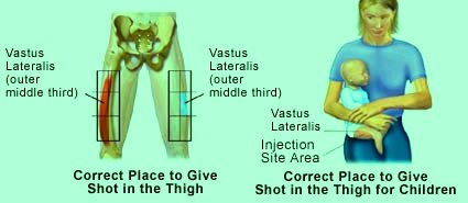 Intramuscular Injection Sites Thigh
