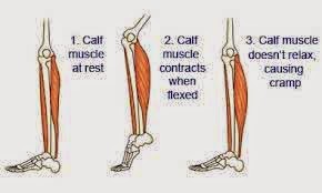KRAM OTOT YANG TERJADI PADA AKTIVITAS BEROLAHRAGA | Insya Allah Berguna
