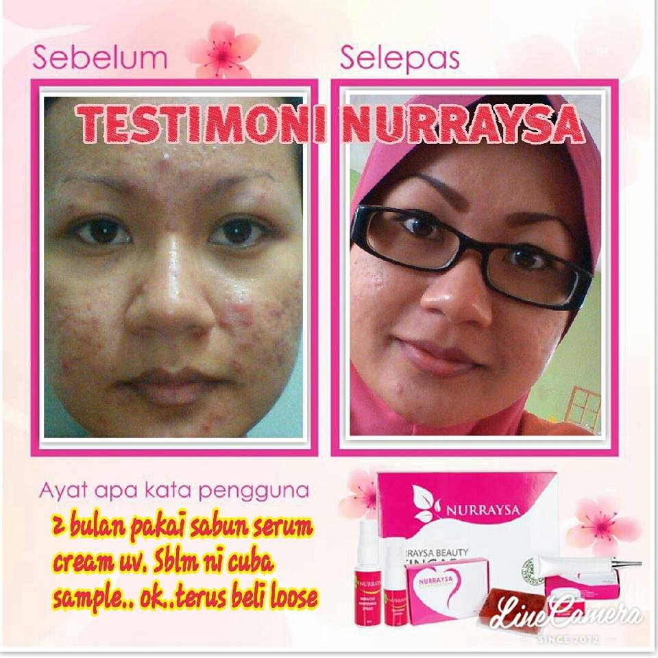 NURRAYSA BEAUTY SKINCARE SET 4IN1 MURAH ~ Skincare & Supplement Shop