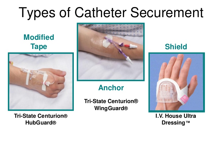 My Mad Med World: Intravenous Cannulation Tips & Tricks