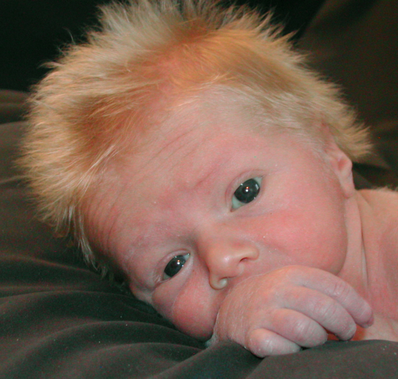 Albums 103+ Pictures Images Of Ugly Babies Latest