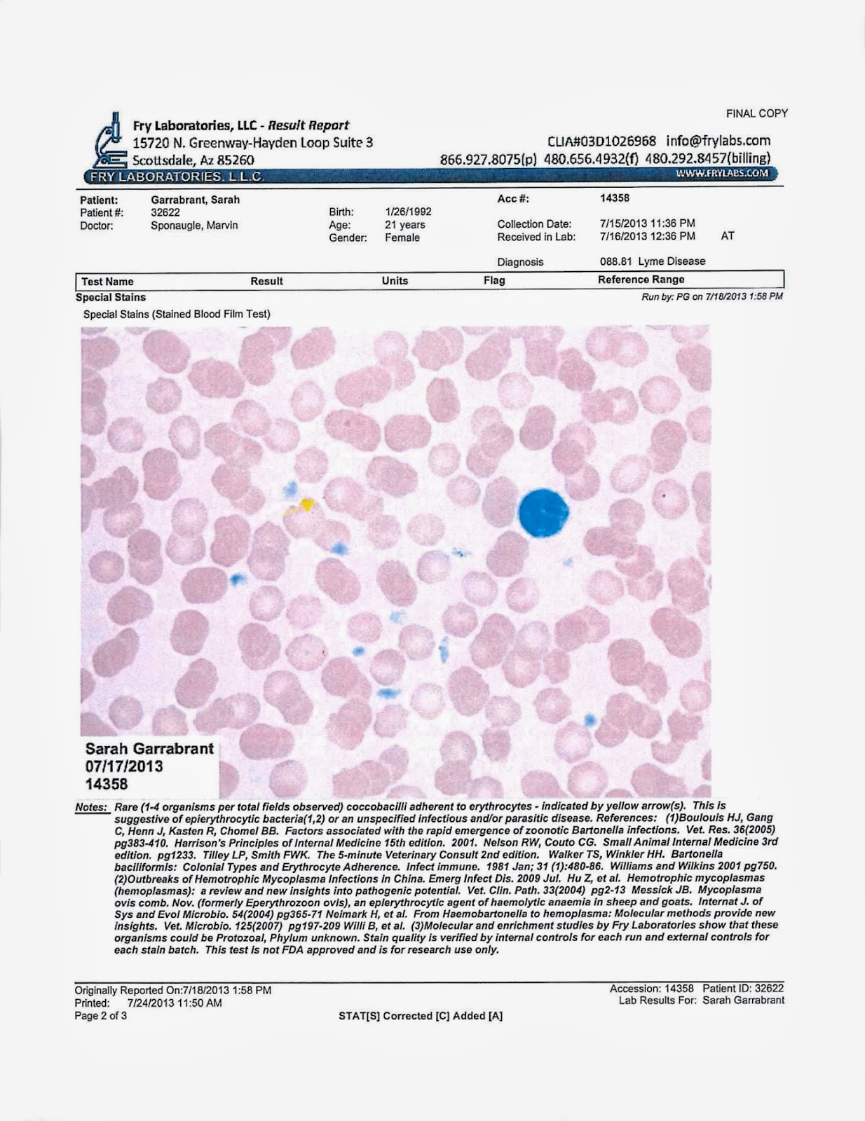 Sarah's treatment at Sponaugle Wellness Institute Sunshine Lyme: Day 57 ...