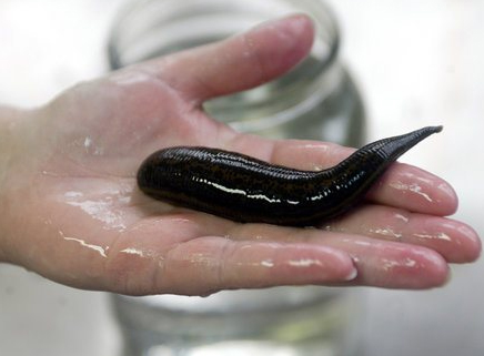 manfaat pengobatan terapi lintah - Master Ilmu Pelet Dan Ilmu Gendam