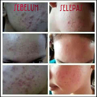 Testimoni Firmax3 Cream - Toko Firmax3 Indonesia