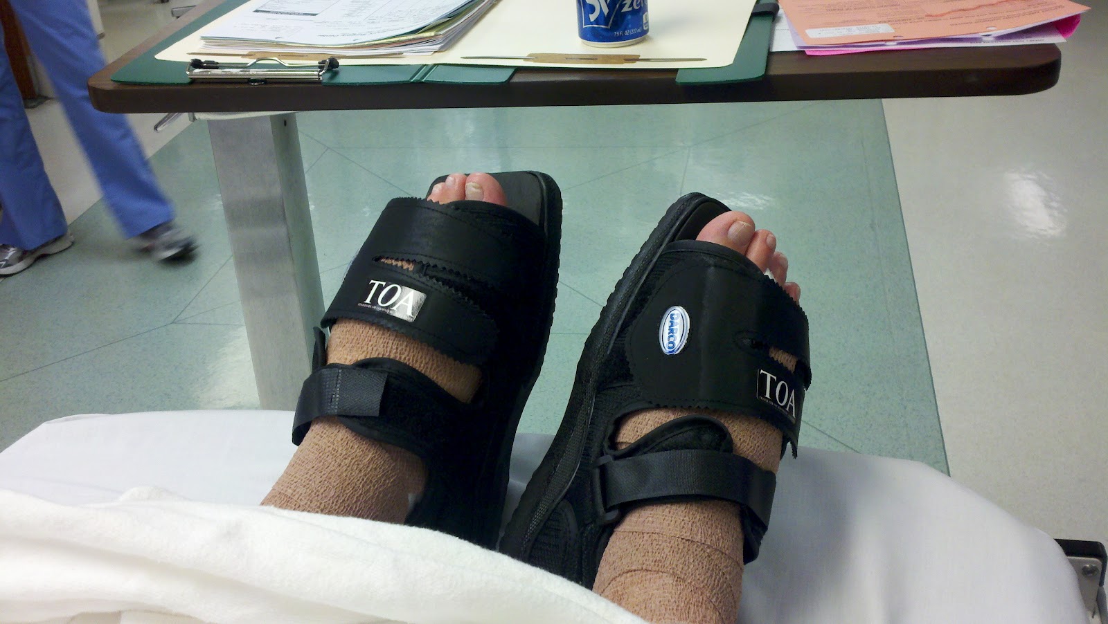 All About Morton's Neuroma: Surgery & Recovery