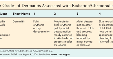 Radiotherapy Dictionary: Radiodermatitis or radiation dermatitis