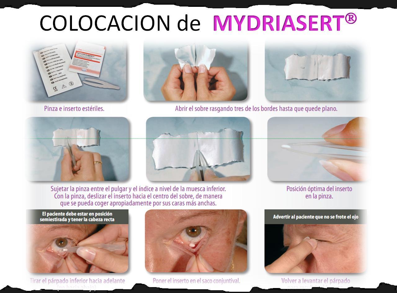 Área Docente: Buena solución para...DILATAR PUPILA