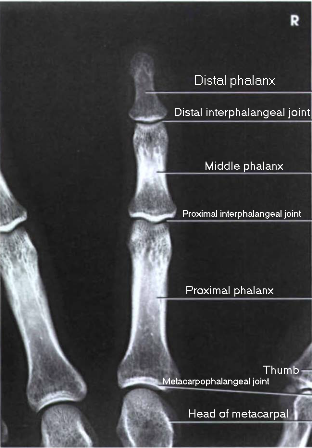 PA PROJECTION : FINGERS - Radiographic Positioning | Radiology Notes