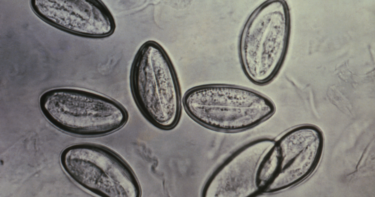 enterobius vermicularis