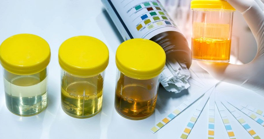 o tratamento da doença renal: Como o paciente com nefrose diabética ...