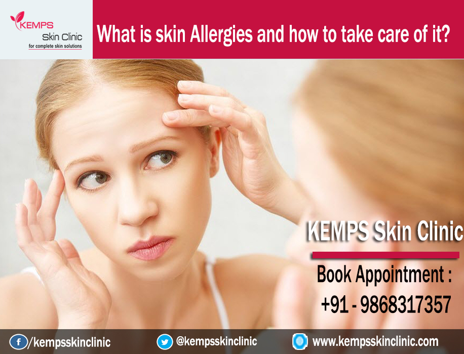 What is skin Allergies and how to take care of it? | KEMPS Skin Clinic
