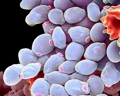 Imágenes de Salud: Imágenes del hongo candida albicans