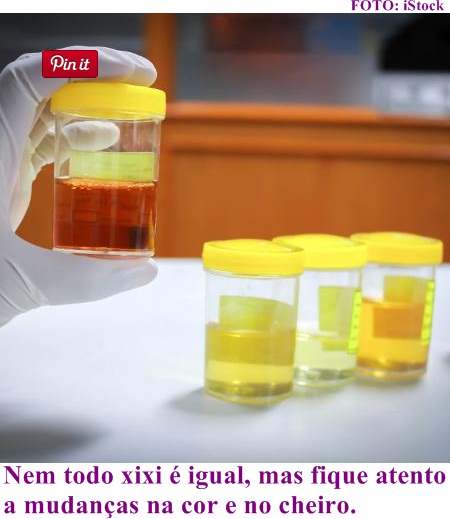 Innaldo Sardinha: URINA VERDE, ROSA OU COM ESPUMA? SAIBA O QUE O XIXI ...