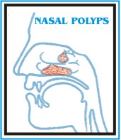 Nasal Polyps Cancer