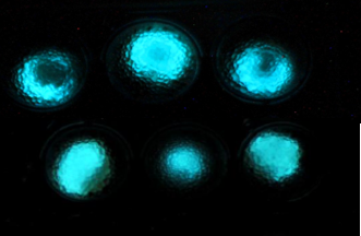 Angels Glow- Bacteria That Saved Civil Soliders