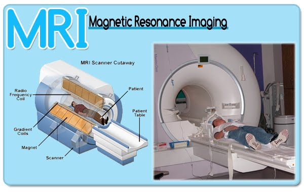 Kecerdasan Buatan Teknologi MRI | Ilmu Teknik
