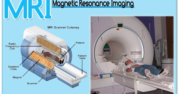 Kecerdasan Buatan Teknologi MRI | Ilmu Teknik