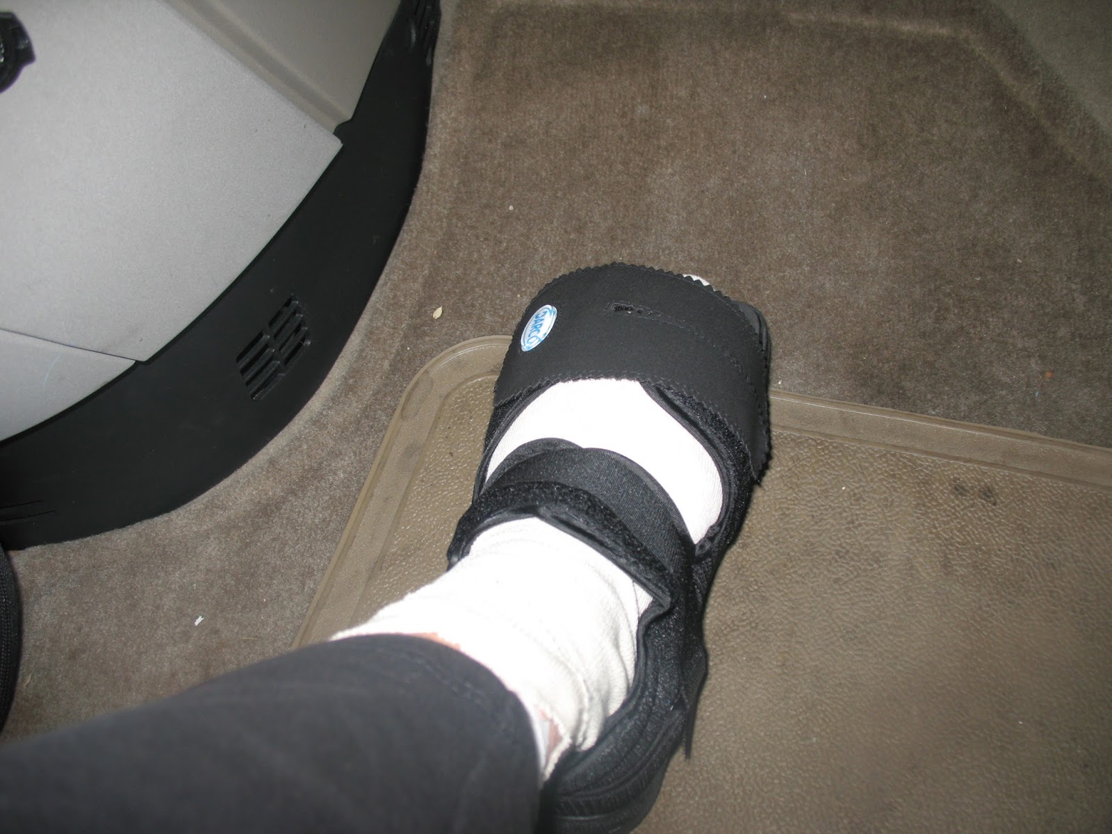 Bunionectomy Surgery Information And Explanation