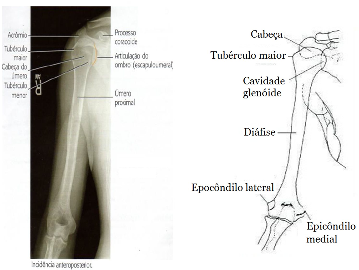 Laboratório de Roentgen: Membros Superiores Parte 2