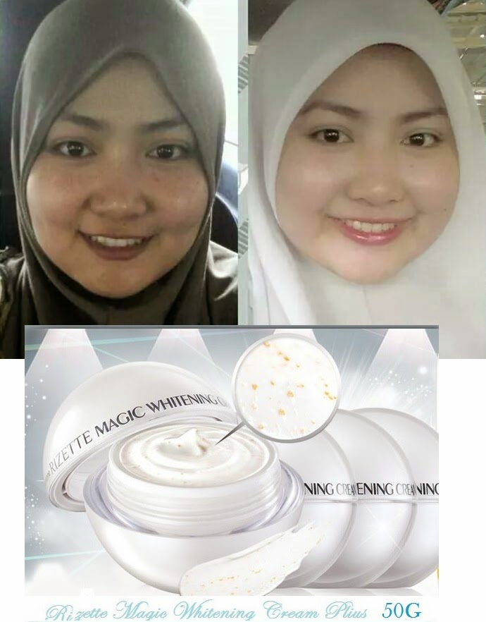 Rizette: Rizette Magic Whitening Cream plus OFFER RM189.00 Krim Magic ...