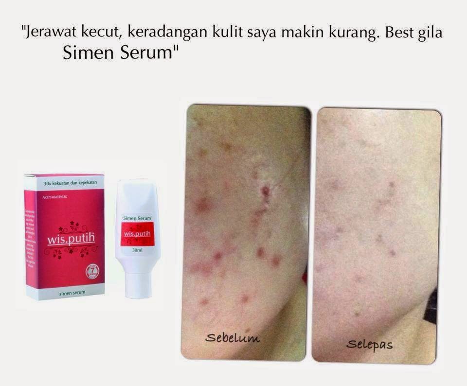 Cik Bebeq Beauty Shop : SERUM SIMEN WIS PUTIH - HARGA TERBAEK UTK COMBO ...