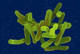 Infection Landscapes: Shigellosis