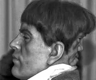 Buenos Datos: ¿Conoces a Edward Mordrake?: El hombre de los 2 rostros