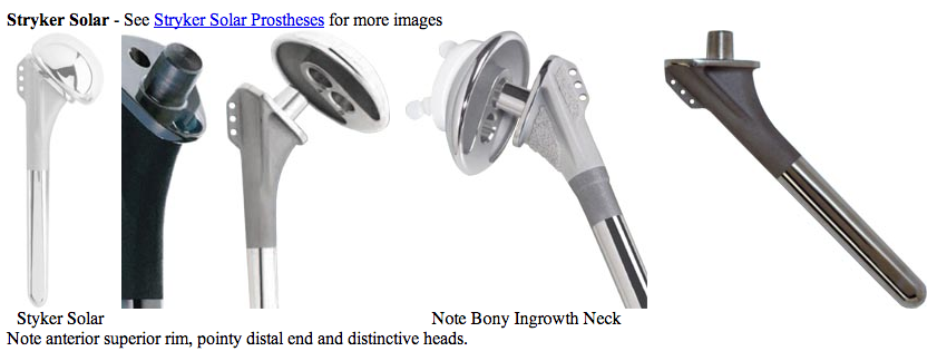 Shoulder and Elbow Surgery: Identifying the implanted shoulder ...