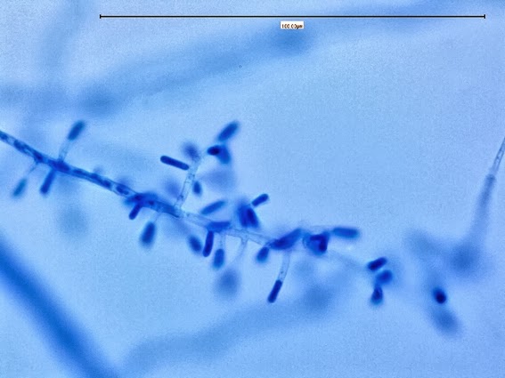 Fun With Microbiology (What's Buggin' You?): Trichophyton terrestre