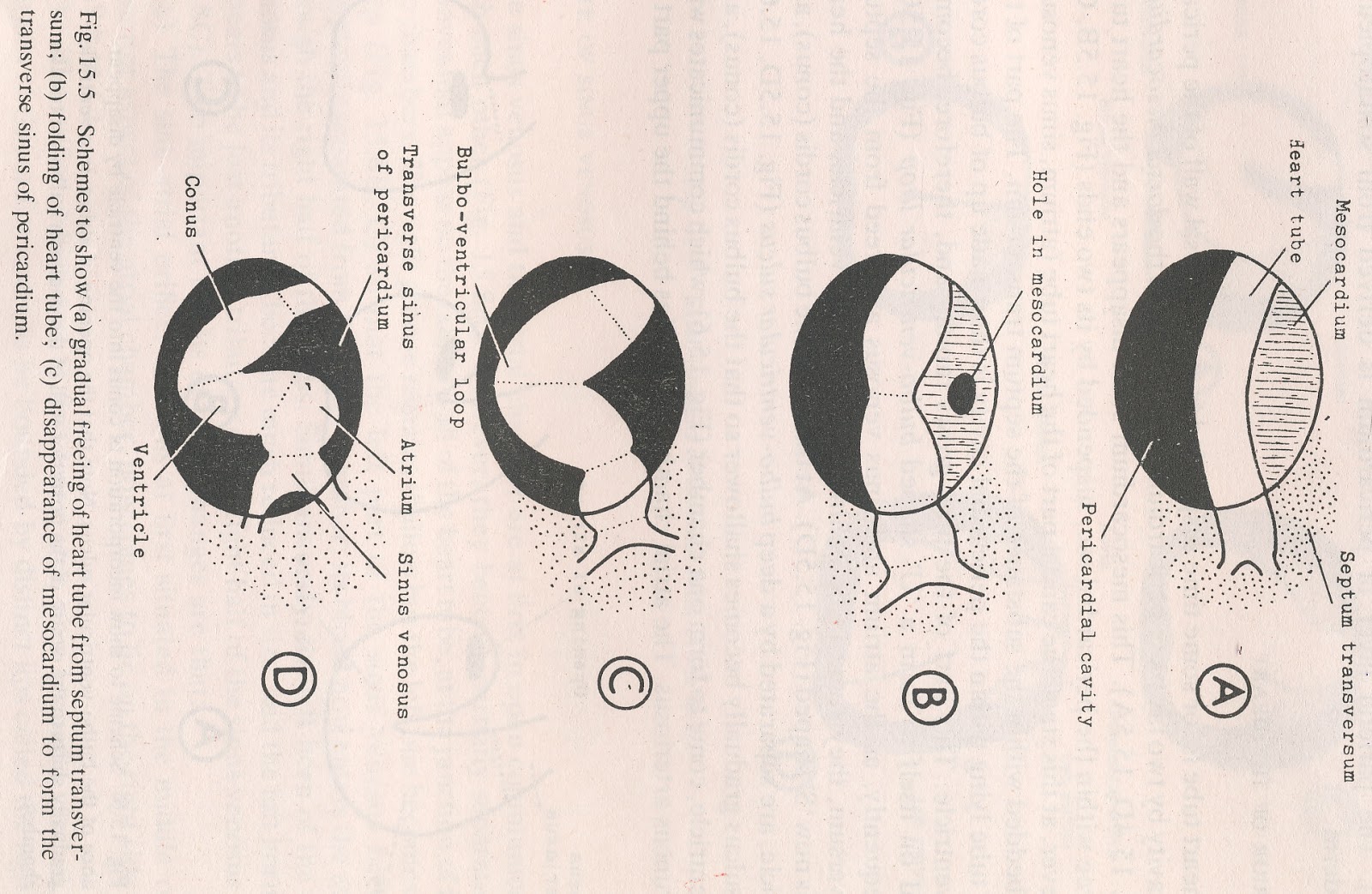 Pedi cardiology: Development: Heart Tube & Looping