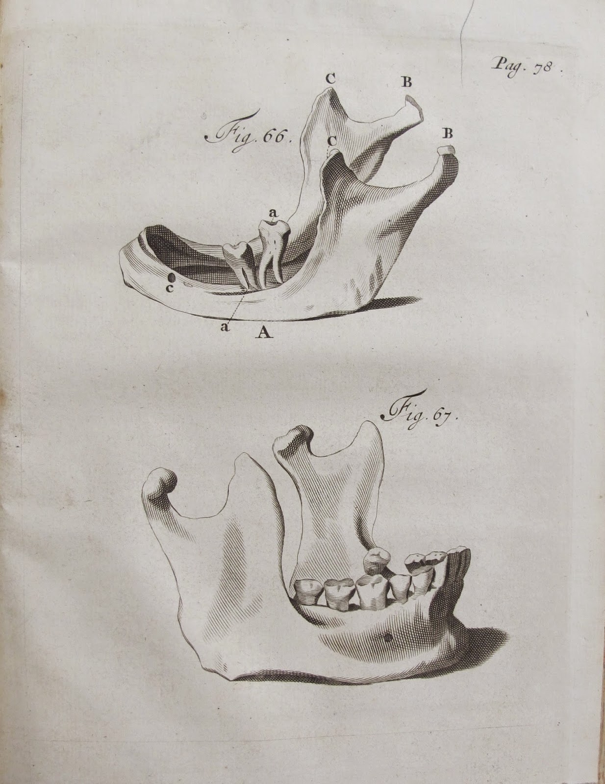 Frederik Ruysch (1638-1731)