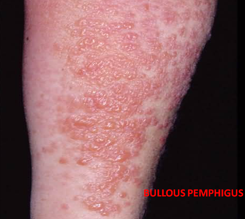 MBBS Medicine (Humanity First): Skin histology