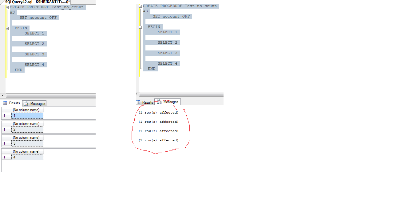 Learn MsSql Server: Importance of SET NOCOUNT in Stored Procedures