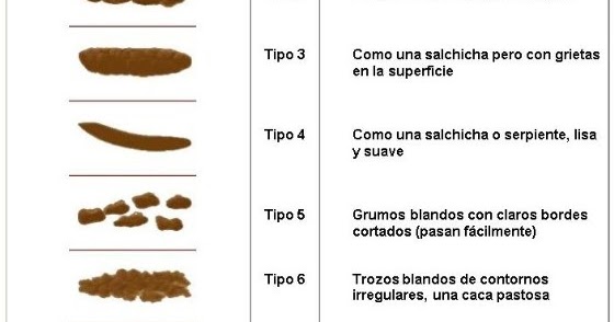 The philosopher: Los colores y formas de las heces y su significado.