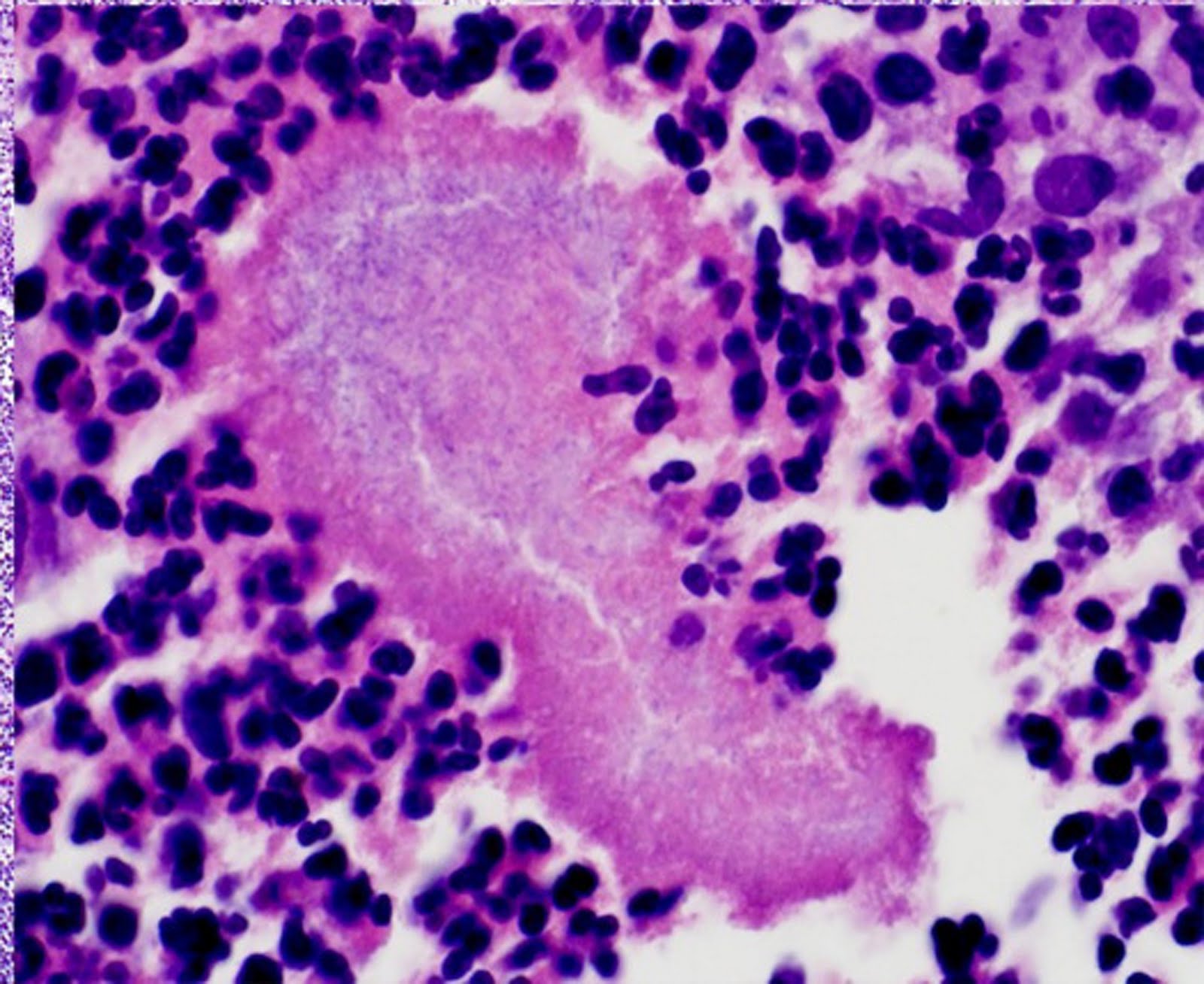 Coated Arms : Crystal Violet