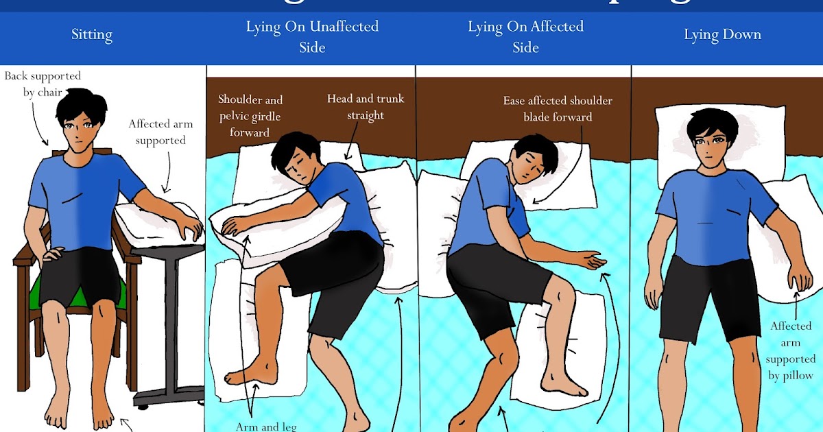 Carer Training Information: Positioning for Left Hemiplegia Carer Training Information: Positioning for Left Hemiplegia
