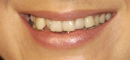 cleveland854321: DENTAL SURGERY WITH THE STARS