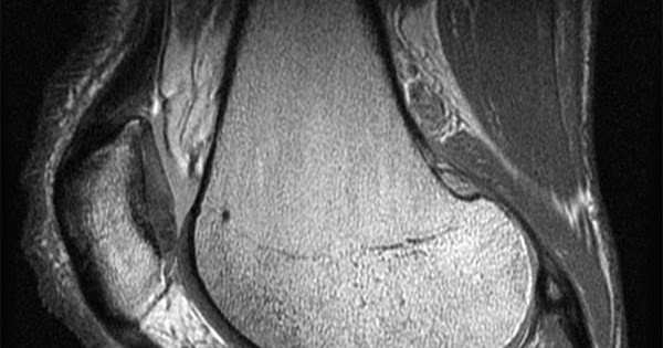 Sarsen Technology Blog: In the Spotlight - Trenton Systems Medical ...