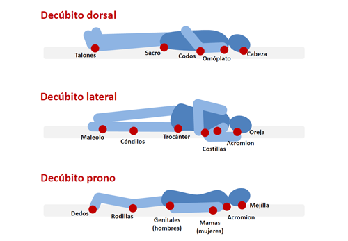 CAPITULO LXXIX: ÚLCERAS POR PRESIÓN.