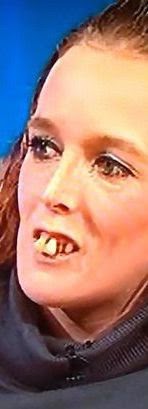 Check out Pics of the teeth that caused Twitter meltdown in the UK ...