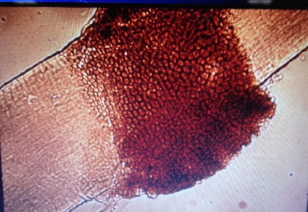 Lecture Notes in Medical Technology: Lecture #16: INTRODUCTION TO MYCOLOGY