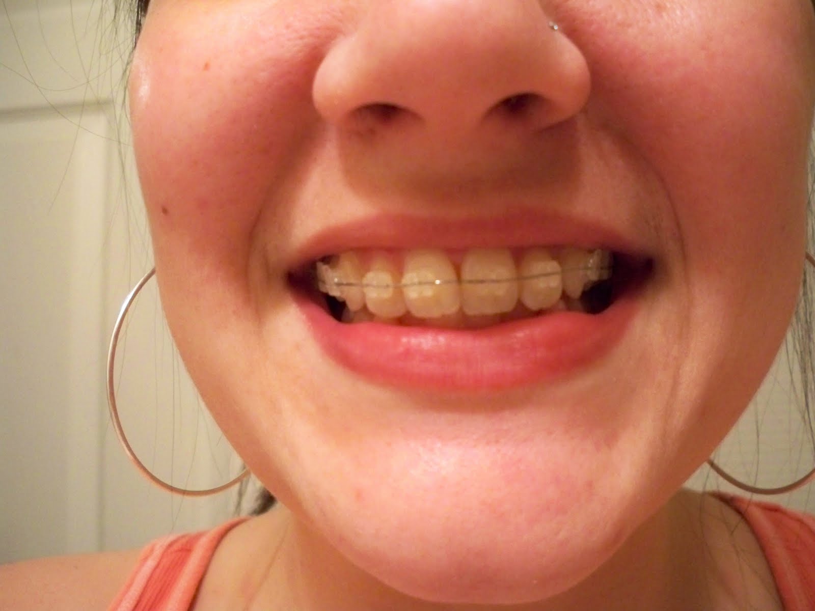 Railroad tracks is an understatement