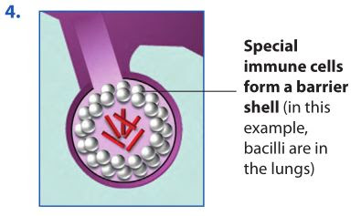 Tuberculosis (TB): Mechanism