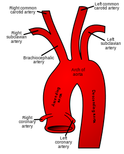 MT Endangerment Sites: 25. Descending Aorta