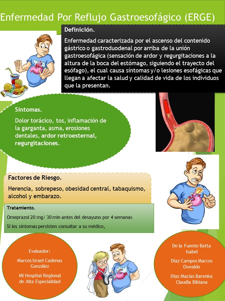 DIVULGACIÓN CIENTÍFICA UG: Enfermedad por Reflujo Gastroesofágico