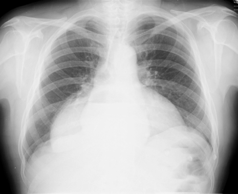 REMI: Imagen nº 16. Diagnóstico a primera vista